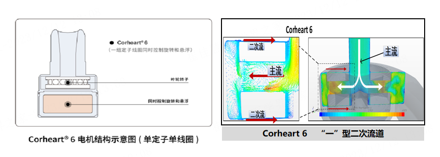 中国智造出海，这颗人工心为何让欧盟医生眼前一亮？ - 知乎