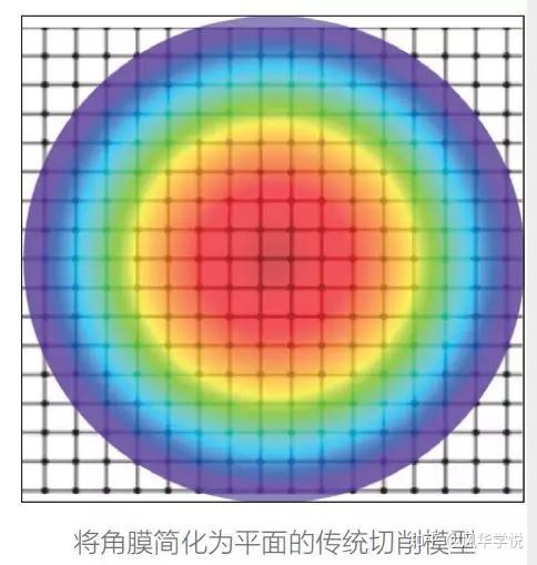 揭秘：TPRK、Smart全激光手术有什么区别？Smart到底好在哪里？ - 知乎
