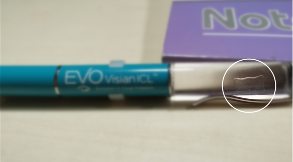 ICL晶体植入近视手术——检查手术全流程（收藏版） - 知乎