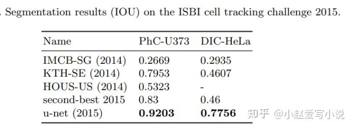 Unet论文超级详解（附图文：超细节超容易理解） - 知乎