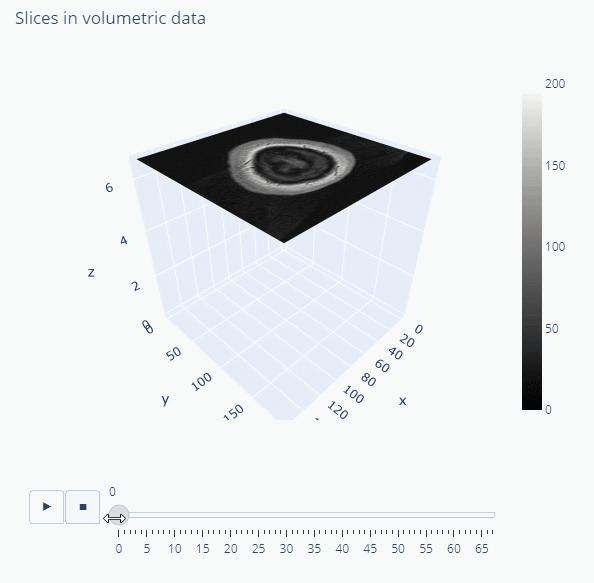 5大Python可视化库到底选哪个好？一篇文章搞定从选库到教学 - 知乎