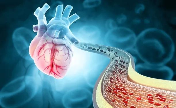 SCI期刊推荐:CIRCULATION-CARDIOVASCULAR INTERVENTIONS - 知乎