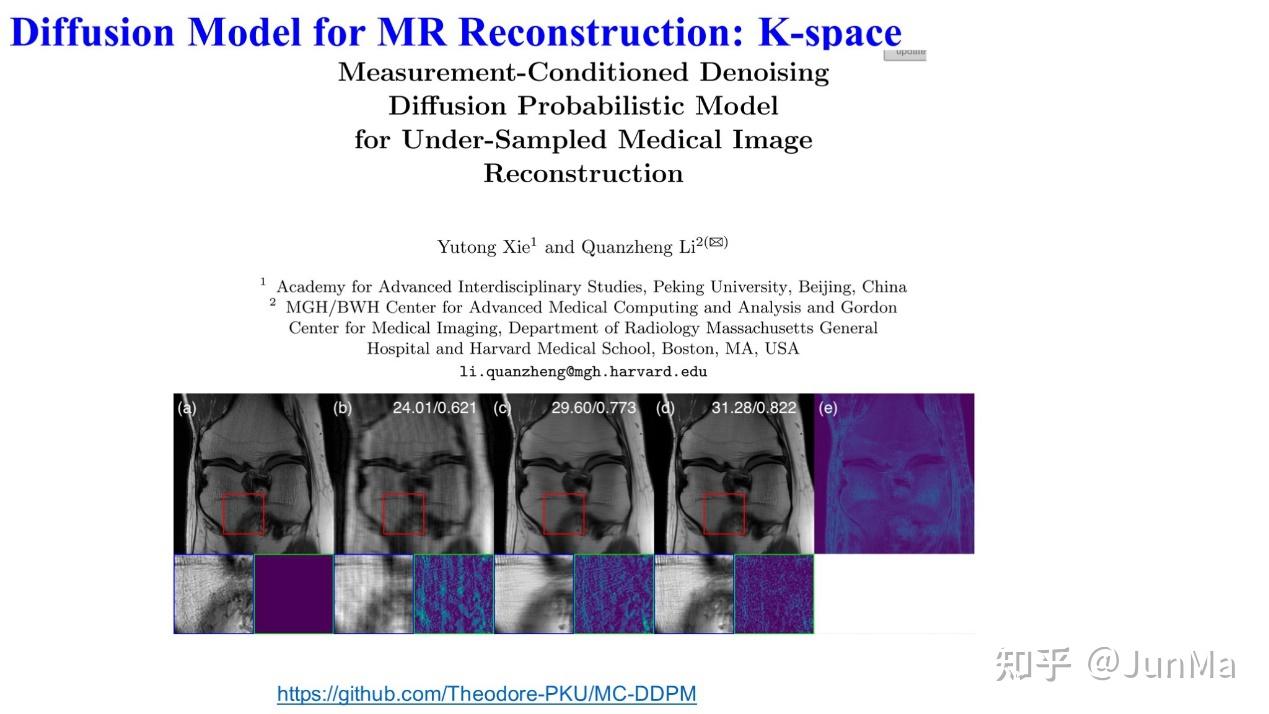 Diffusion Models in MICCAI 2022 - 知乎