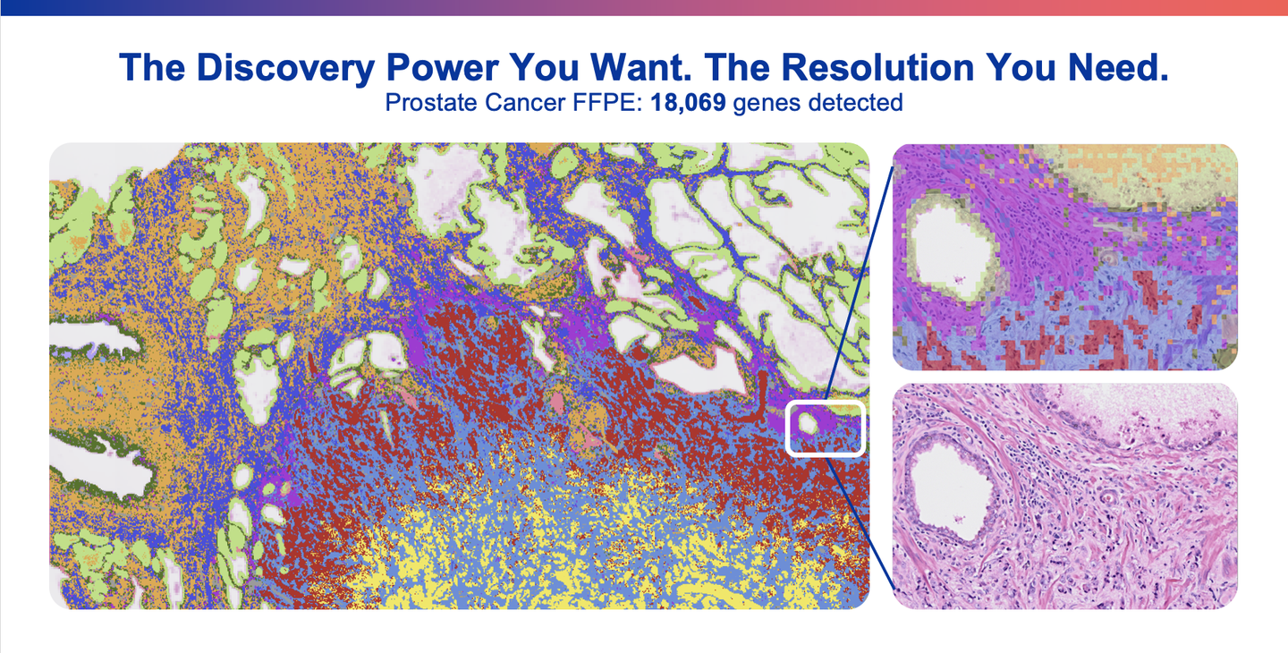 Visium HD 全流程分析--数据准备 - 知乎