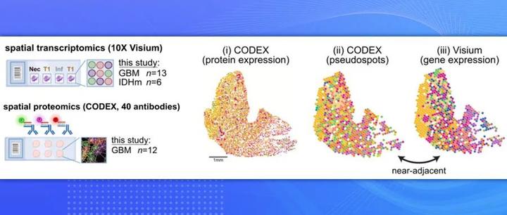 Cell长文：肿瘤研究中PhenoCycler-Fusion空间单细胞蛋白组学（简称PCF,原CODEX）如何提升10x 空转数据层次 - 知乎