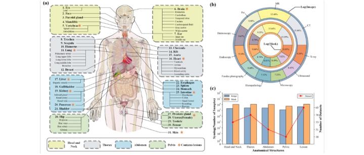 SAM-Med2D：打破自然图像与医学图像的领域鸿沟，医疗版 SAM 开源了！ - 知乎