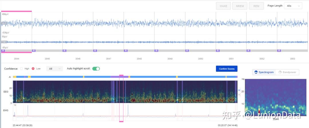 【脑科学】基于EEG的小动物睡眠研究 - 知乎