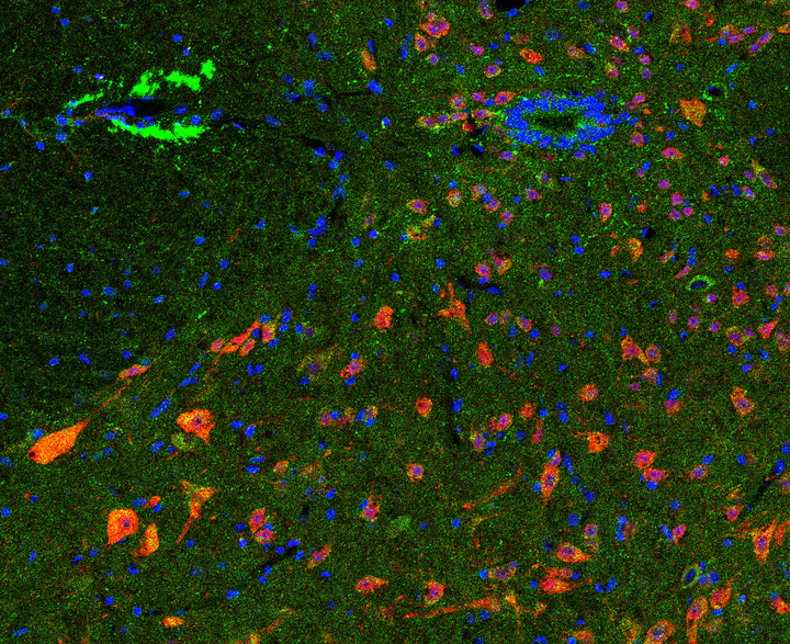 使用Cellpose和ImageJ分析多标细胞荧光强度 - 知乎