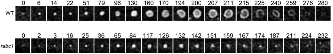 Developmental Cell | 山东大学孙佳琦团队合作揭示RABC1蛋白在营养匮乏条件下调控植物自噬的机制 - 知乎