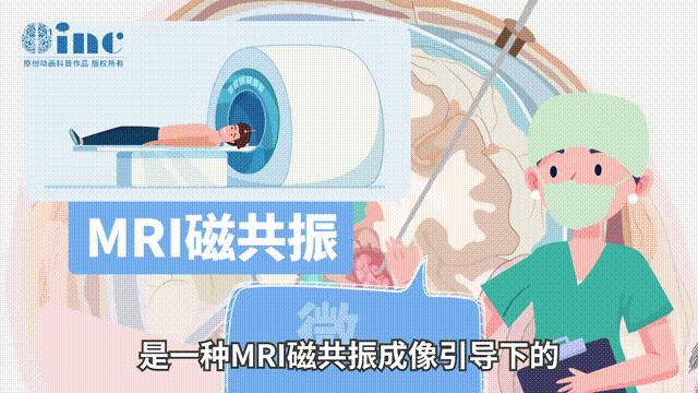 儿童癫痫＆脑瘤治疗新选择：INC（爱恩希）Rutka教授LITT治疗技术真实案例分享！ - 知乎