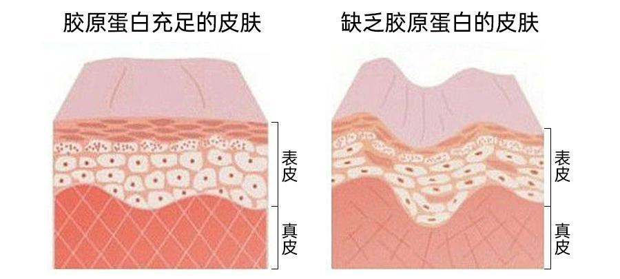 关于基质金属蛋白酶-1（MMP-1）与皮肤衰老的探讨 - 知乎