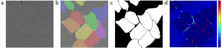 U-Net: Convolutional Networks for Biomedical Image Segmentation - 知乎