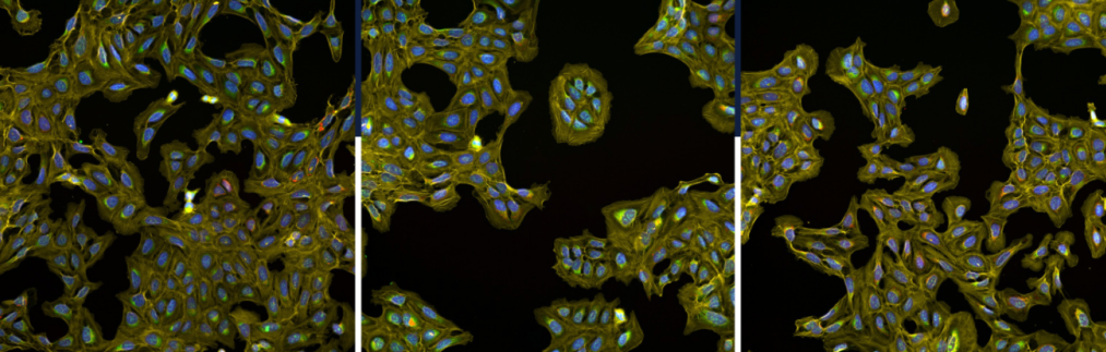 “细胞绘画”技术问世，能加速药物发现，相关公司已启动5项临床试验 - 知乎