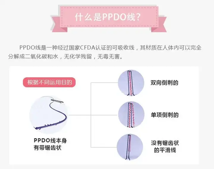 谭超：线雕的线到底是什么线？ - 知乎