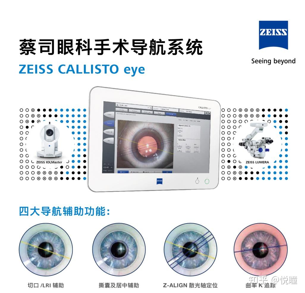 悦曈眼科引进蔡司手术导航系统，开启ICL及白内障精准数字化治疗“领航”时代 - 知乎