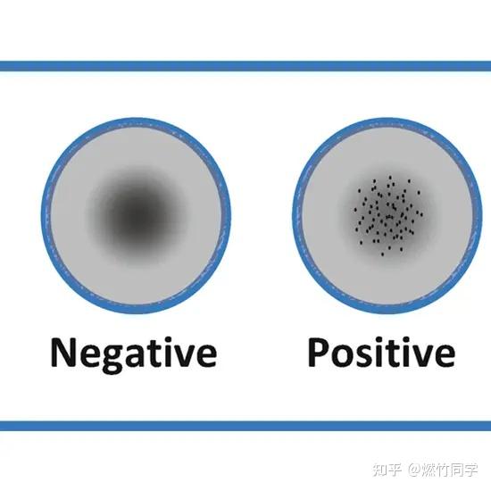 近期遇到的1例在梅毒感染窗口期立即接受治疗，随后特异性抗体和非特异性抗体同时转阴的梅毒患者 - 知乎