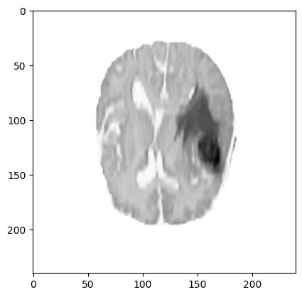 医学图像处理（一）simpleitk打开查看nii图像 - 知乎