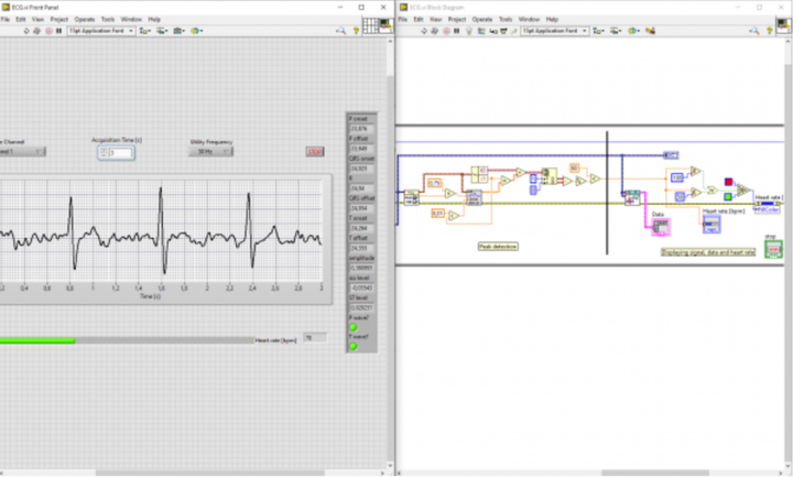 干货分享 | 使用ADS基础实验平台和LabVIEW 搭建心电图测试仪 - 知乎