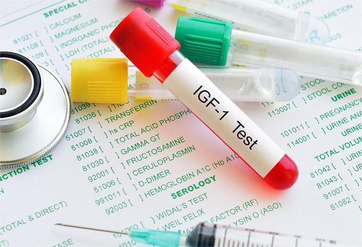 “生长因子”，究竟和身高有什么关系？ - 知乎