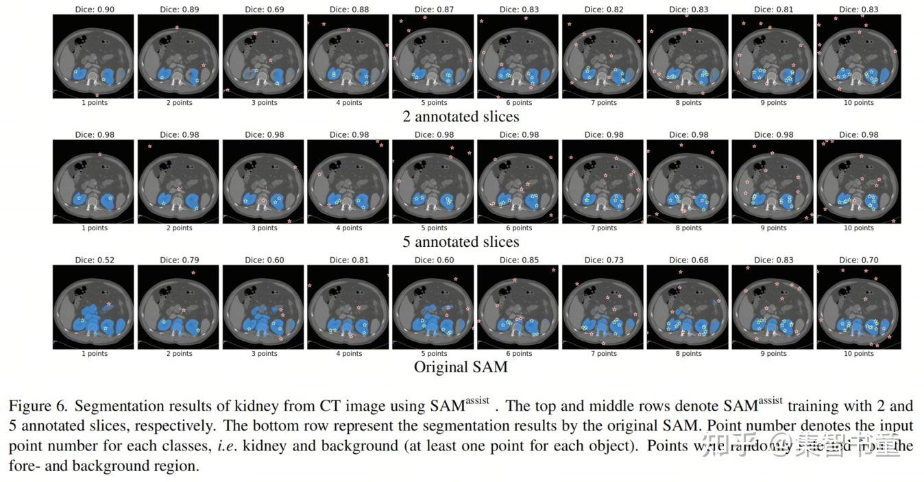 SAM-Med | 英伟达基于SAM提出医学图像标注效率神器 - 知乎