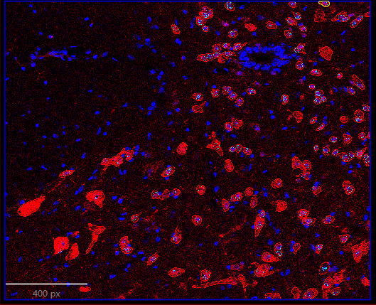 使用QuPath+Cellpose+StarDist分析蛋白入核比率 - 知乎