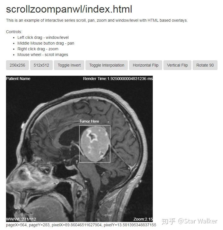从Cornerstone到OHIF Viewer—JS影像前端开发最佳范例 - 知乎