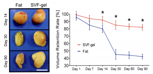 解析：脂芯SVF-gel脂肪胶是什么？它长什么样子？ - 知乎