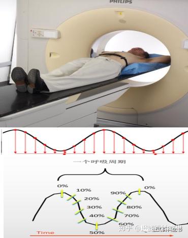 什么是4D CT？4D CT会带来很高的辐射剂量吗？ - 知乎