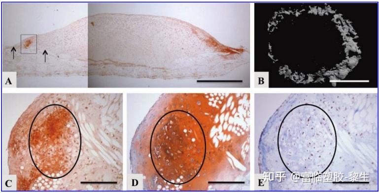 PGA Biofelt植入级无纺布 研究结果表明，长期培养这些结构会导致肥大性软骨细胞表型 - 知乎