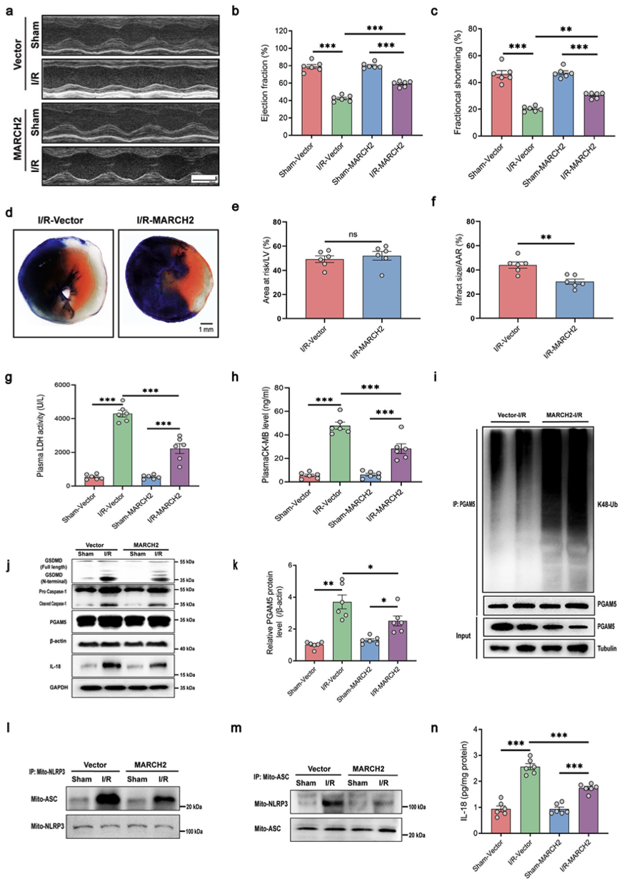 Cell Discovery丨IF：33.5丨MARCH2通过抑制焦亡从而保护心肌缺血再灌注损伤 - 知乎