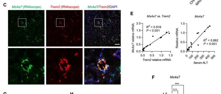 Science子刊丨肝脏危险信号诱导 TREM2+ 巨噬细胞，并通过 MS4A7 依赖性炎症小体激活驱动脂肪性肝炎 - 知乎