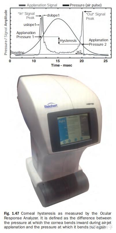 No.24, Ocular response analyser and corneal hysteresis - 知乎