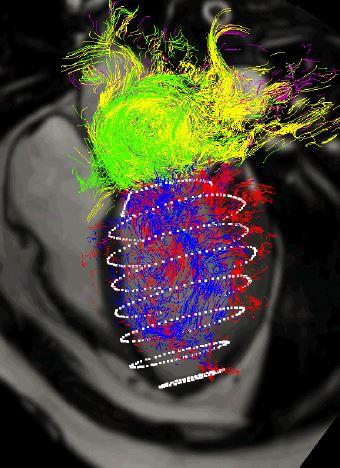 4D-Flow扫描数据采集：序列及参数 - 知乎