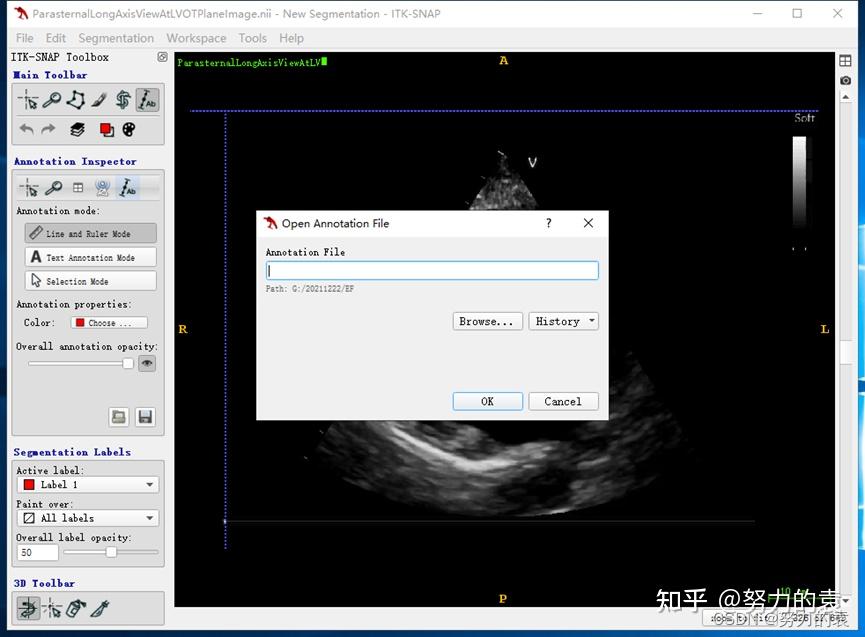 如何使用 ITK-SNAP 标注影像图像？ - 知乎