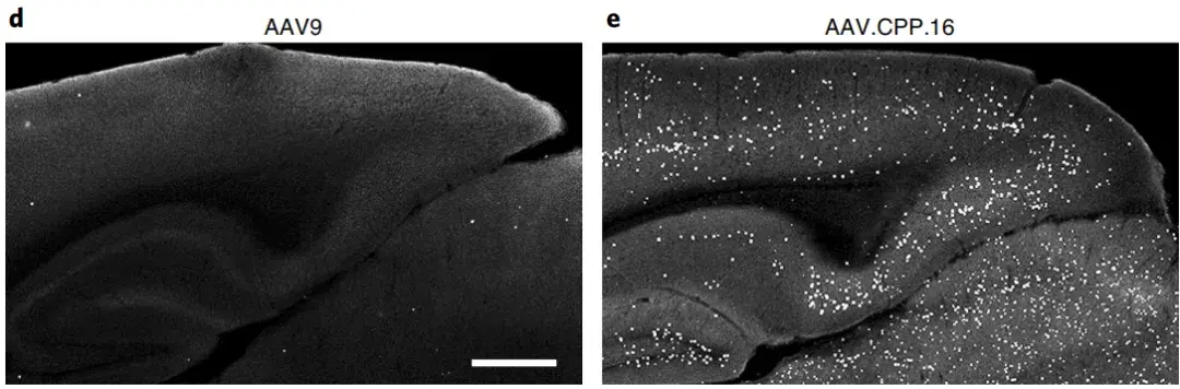 能够穿透血脑屏障的AAV血清型有哪几种？ - 知乎