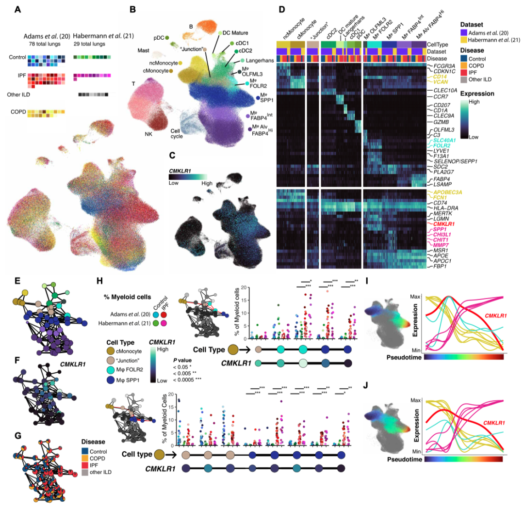 Science Advanes丨通过CMKLR1靶向成像对肺部炎症-纤维化轴进行非侵入性评估 - 知乎