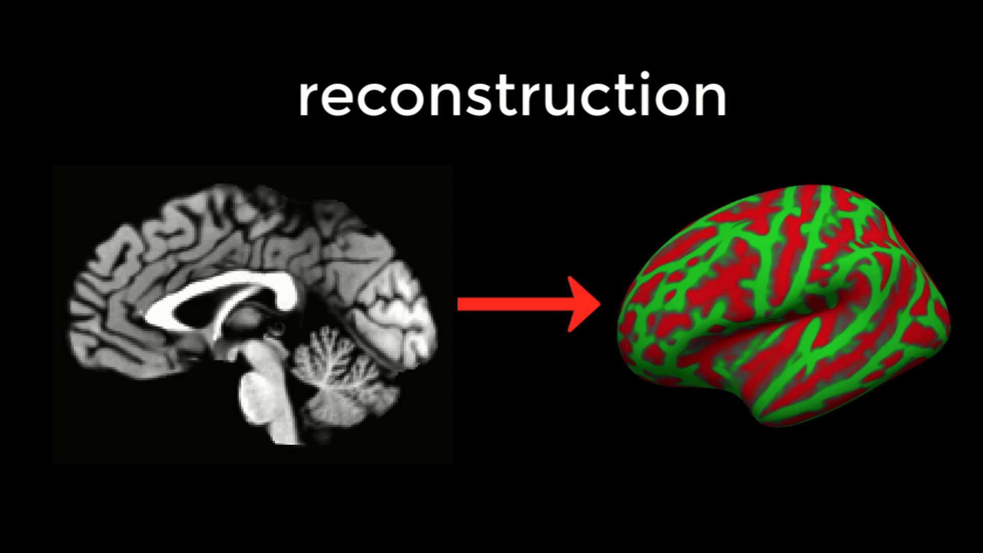 recon-all处理图像过程 - 知乎