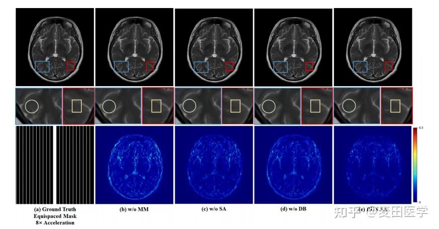 用于多模态MRI重建的具有空间对齐的深度展开网络|文献速递--基于多模态-半监督深度学习的病理学诊断与病灶分割 - 知乎