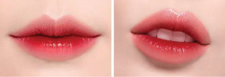 人中缩短？ 花瓣唇？M唇？你需要注意！ - 知乎