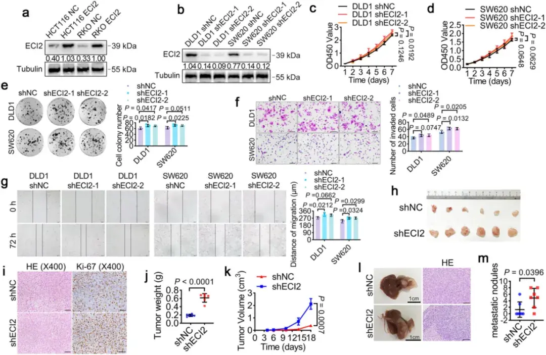 Nature子刊｜ 南方医科大学李学农团队揭示ECI2抑制结直肠癌的机制 - 知乎