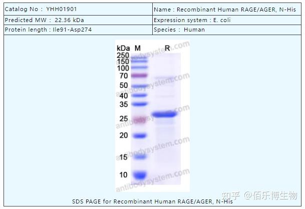 【佰乐博生物】晚期糖基化终产物受体-AGER/RAGE蛋白与抗体 - 知乎