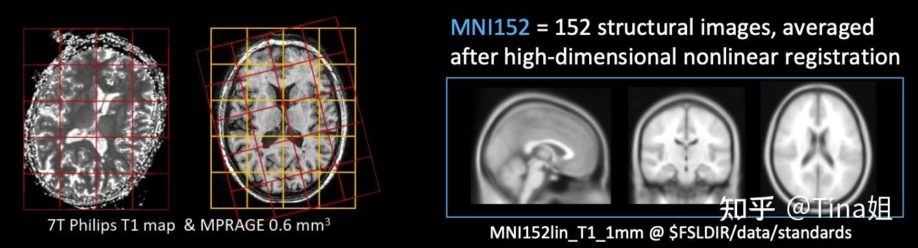 介绍一款 MRI&CT 图像预处理强大工具--FSL - 知乎