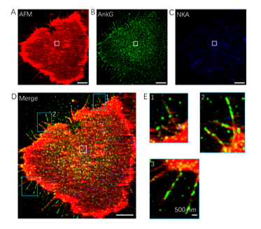 NKA和AnkG在HBE细胞膜中的定位 一 - 知乎