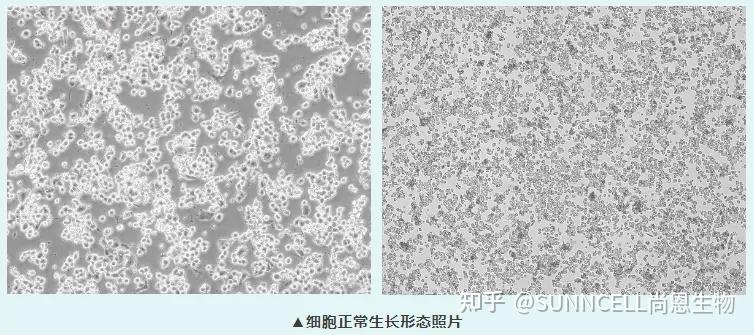 Neuro-2a(小鼠脑神经瘤细胞)培养注意事项 - 知乎