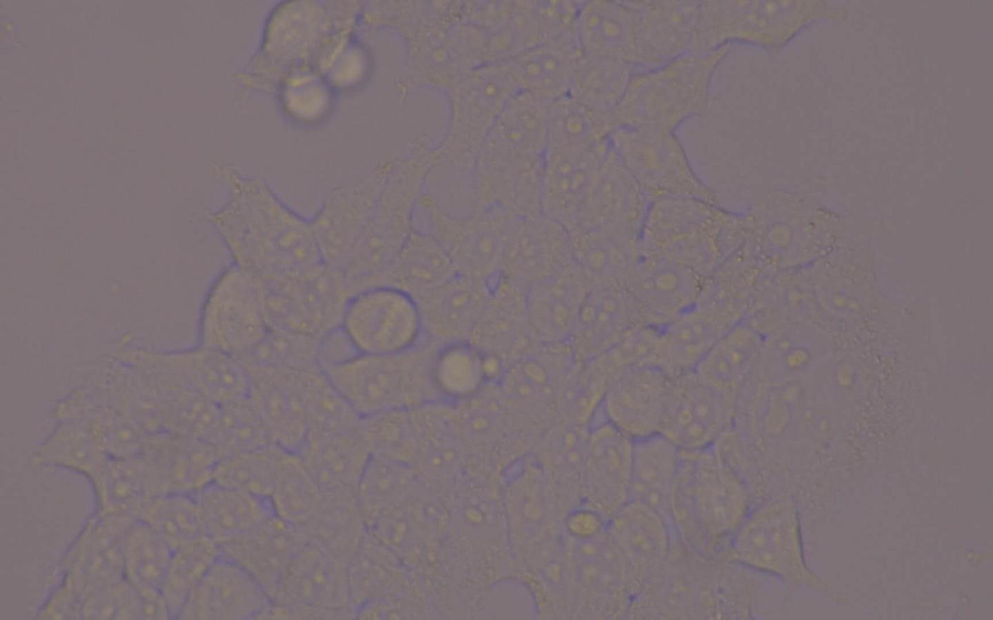 293T细胞在显微镜下的形态 - 知乎