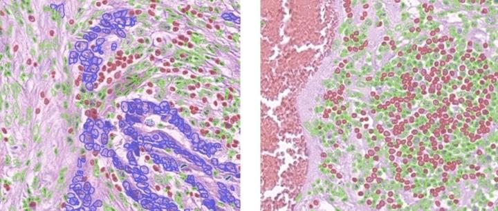 HoVer-Net复现：手把手带你实现细胞核的分割与分类，并输出叠加图像｜24-06-21 - 知乎