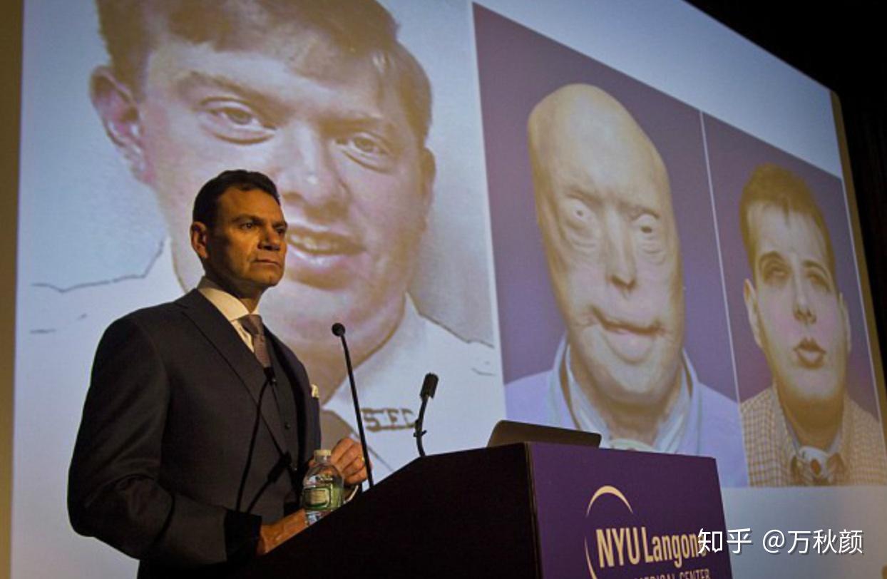 整容的极限是什么？ - 知乎