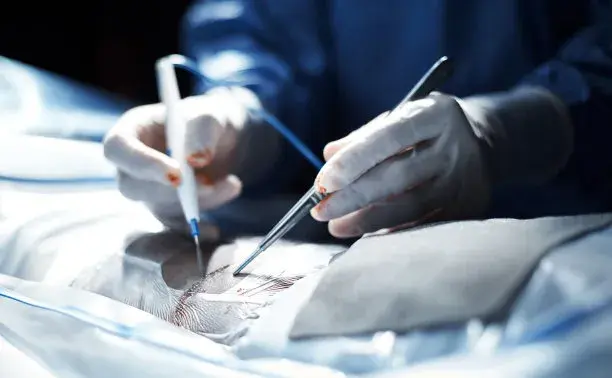 SCI期刊介绍：UPDATES IN SURGERY - 知乎