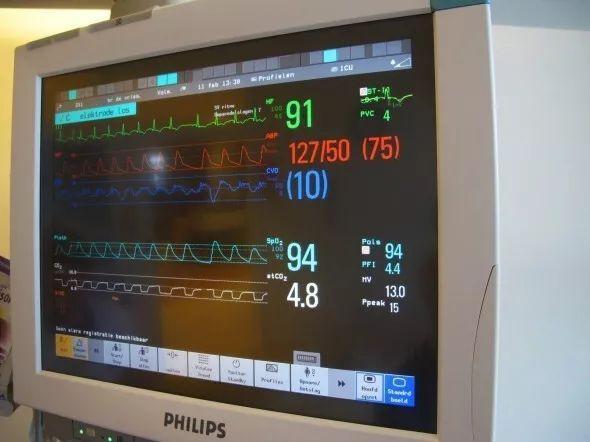 住在重症监护室（ICU）是怎样一种体验？ - 知乎