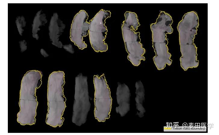 PViT-AIR：基于视觉转换器的乳腺组织多组学和Faxitron图像仿射配准|文献速递-生成式模型与transformer在医学影像中的应用 ...